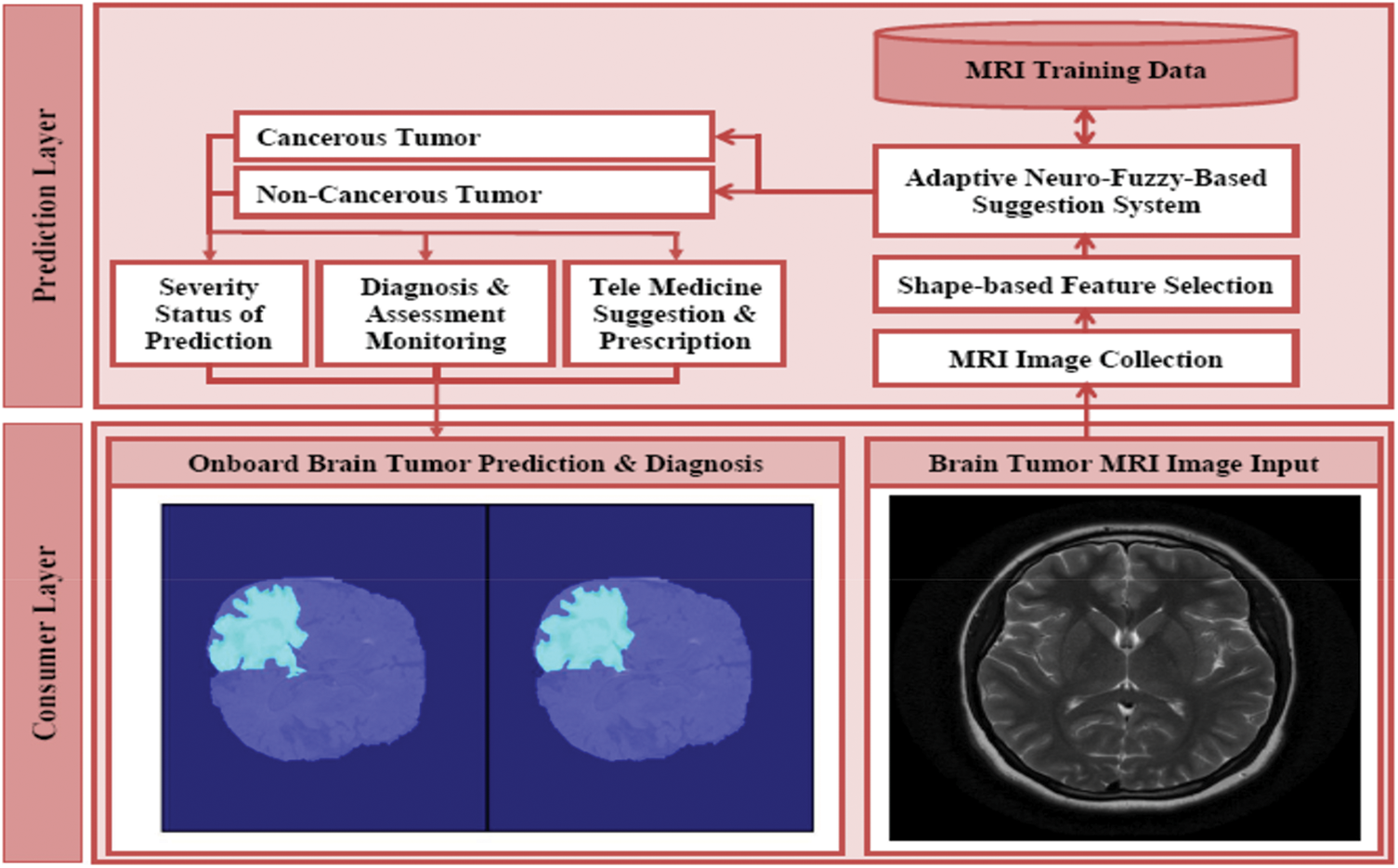 Real Time Brain Tumor Prediction Using Adaptive Neuro Fuzzy Technique