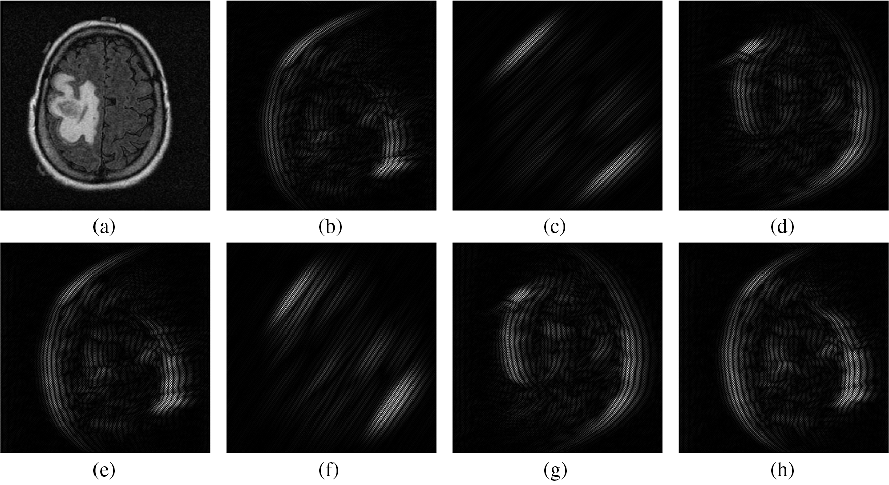 Bendlets and Ensemble Learning Based MRI Brain Classification System