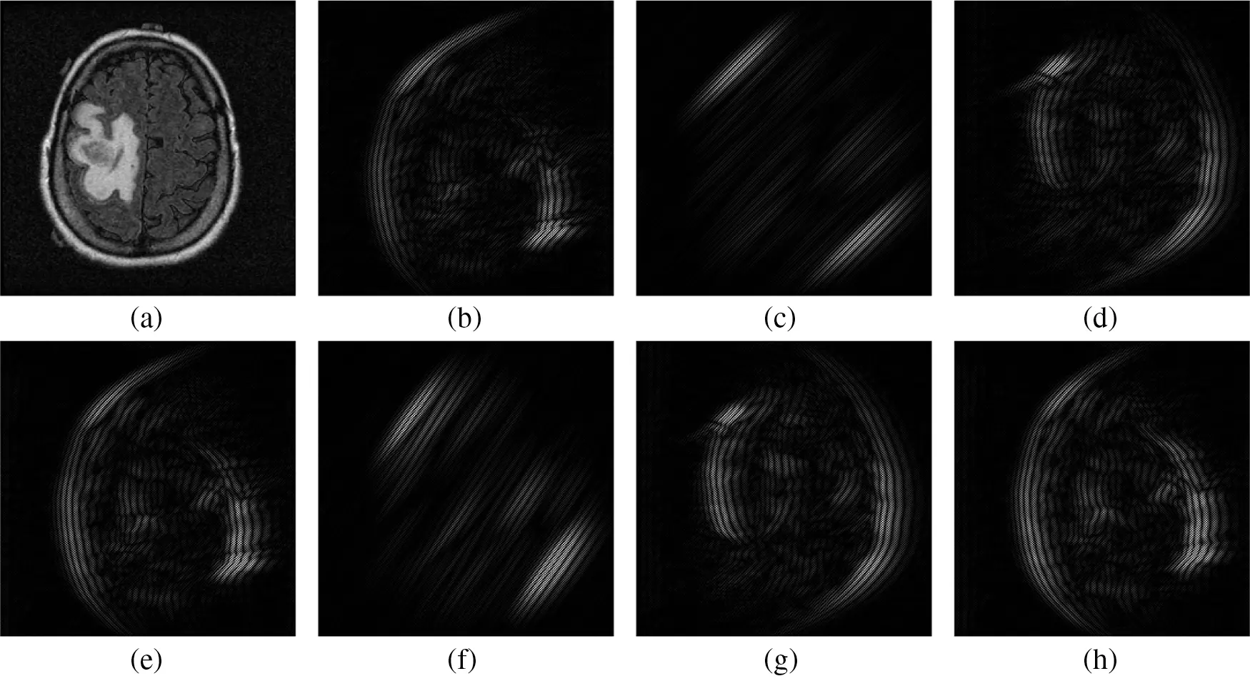 Bendlets and Ensemble Learning Based MRI Brain Classification System