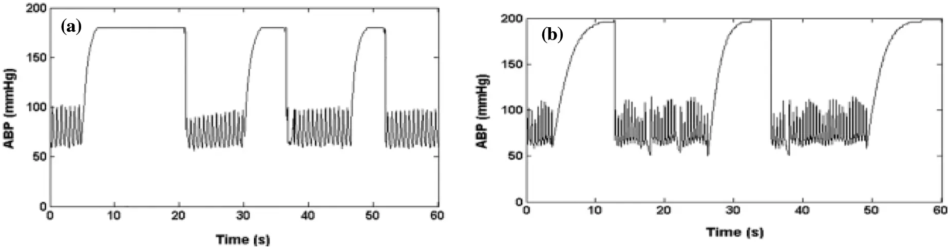 False Alarm Reduction in ICU Using Ensemble Classifier Approach