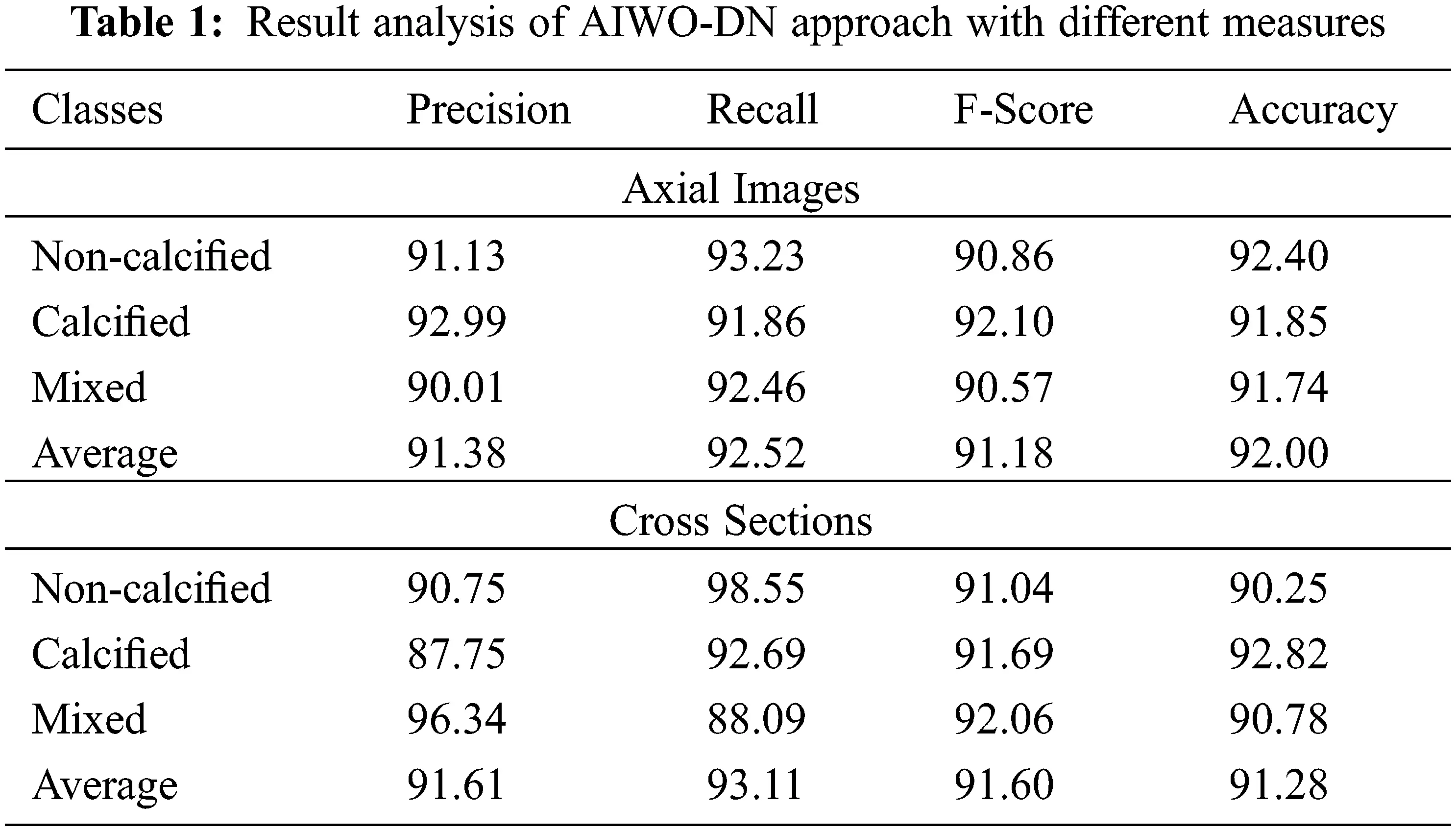 Computer Aided Coronary Atherosclerosis Plaque Detection and Classification