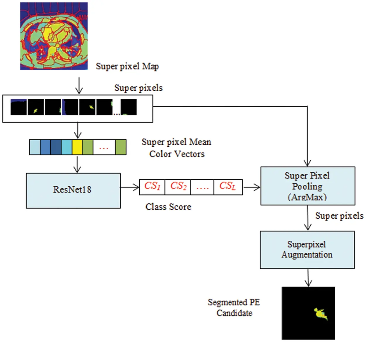 A Novel Deep Learning Framework for Pulmonary Embolism Detection for Covid-19 Management