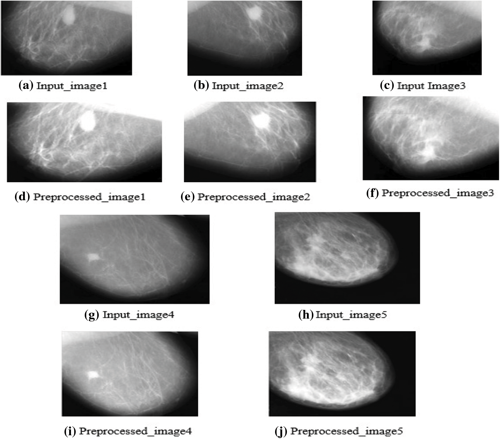 Adaptive Resource Allocation Neural Network-Based Mammogram Image Segmentation and Classification