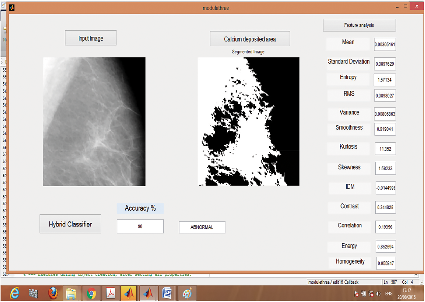 Adaptive Resource Allocation Neural Network-Based Mammogram Image Segmentation and Classification