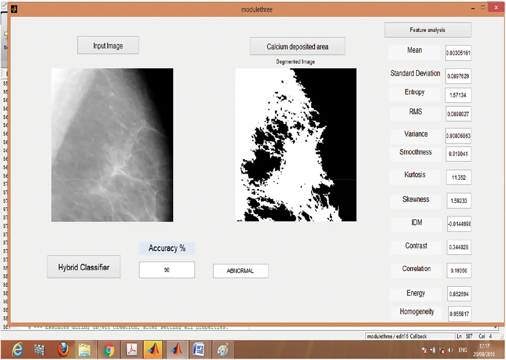 Adaptive Resource Allocation Neural Network-Based Mammogram Image Segmentation and Classification