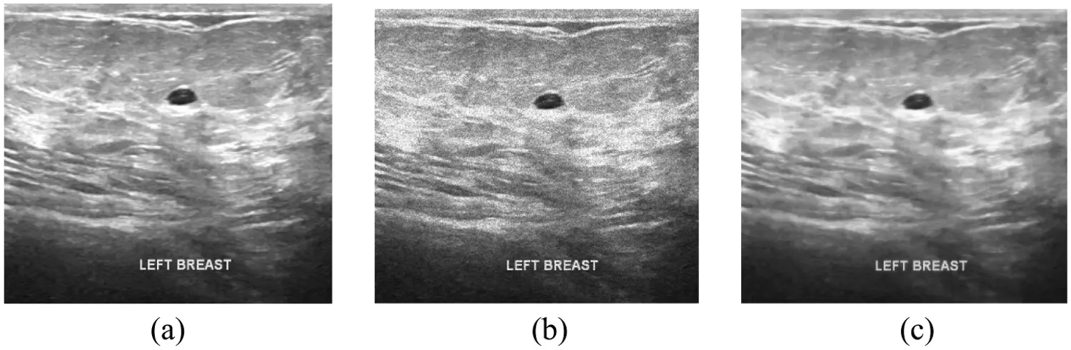 Extended Speckle Reduction Anisotropic Diffusion Filter to Despeckle ...