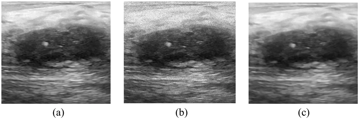 Extended Speckle Reduction Anisotropic Diffusion Filter to Despeckle ...