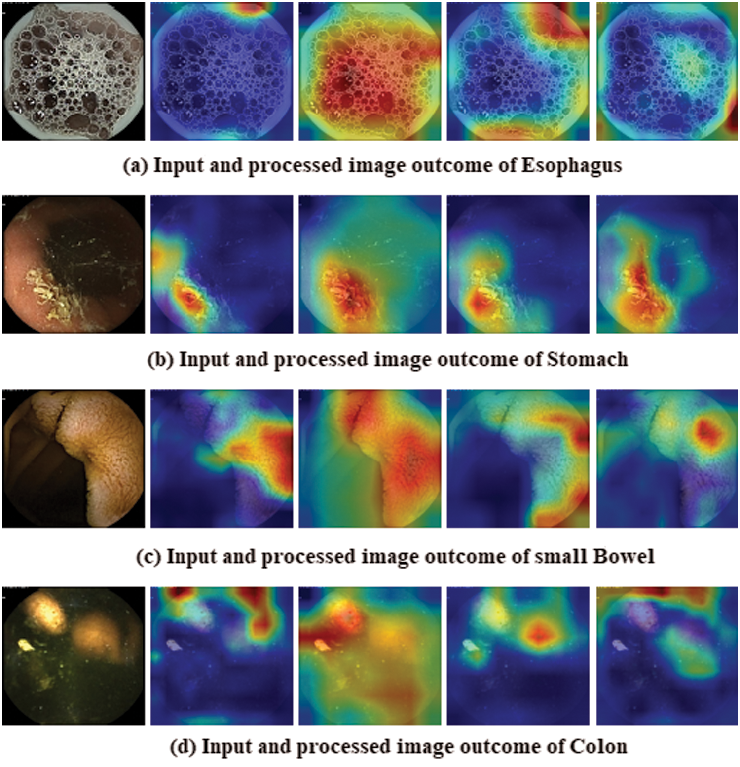 Anatomical Region Detection Scheme Using Deep Learning Model in Video ...