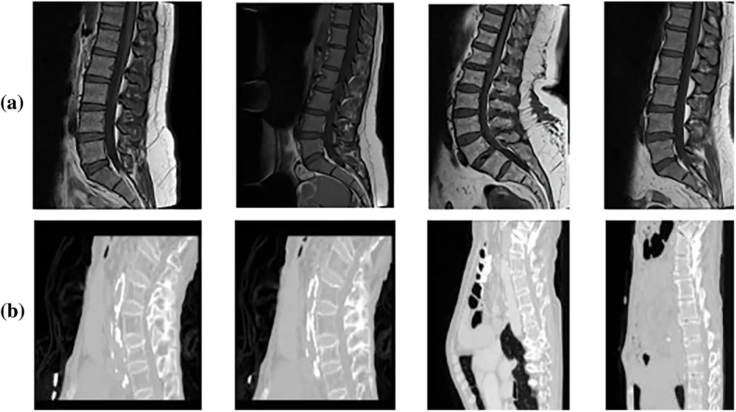 Automatic Localization and Segmentation of Vertebrae for Cobb Estimation and Curvature Deformity