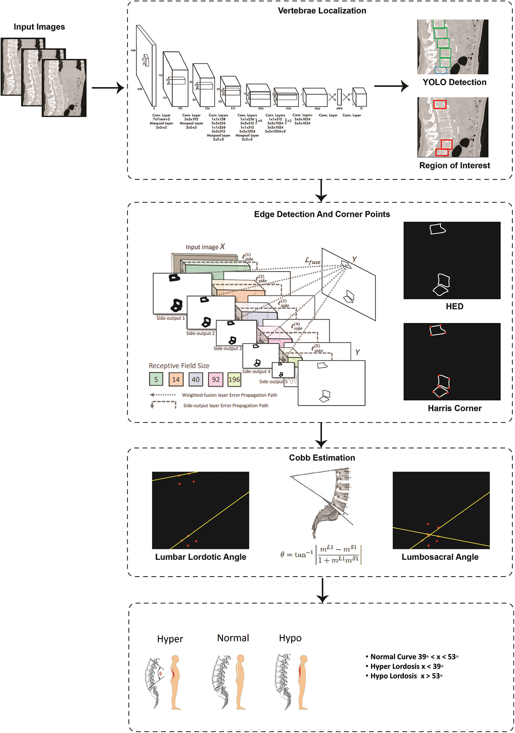 Automatic Localization and Segmentation of Vertebrae for Cobb Estimation and Curvature Deformity