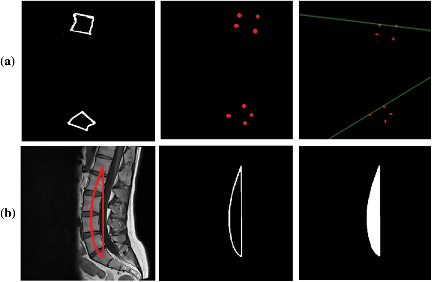 Automatic Localization and Segmentation of Vertebrae for Cobb Estimation and Curvature Deformity