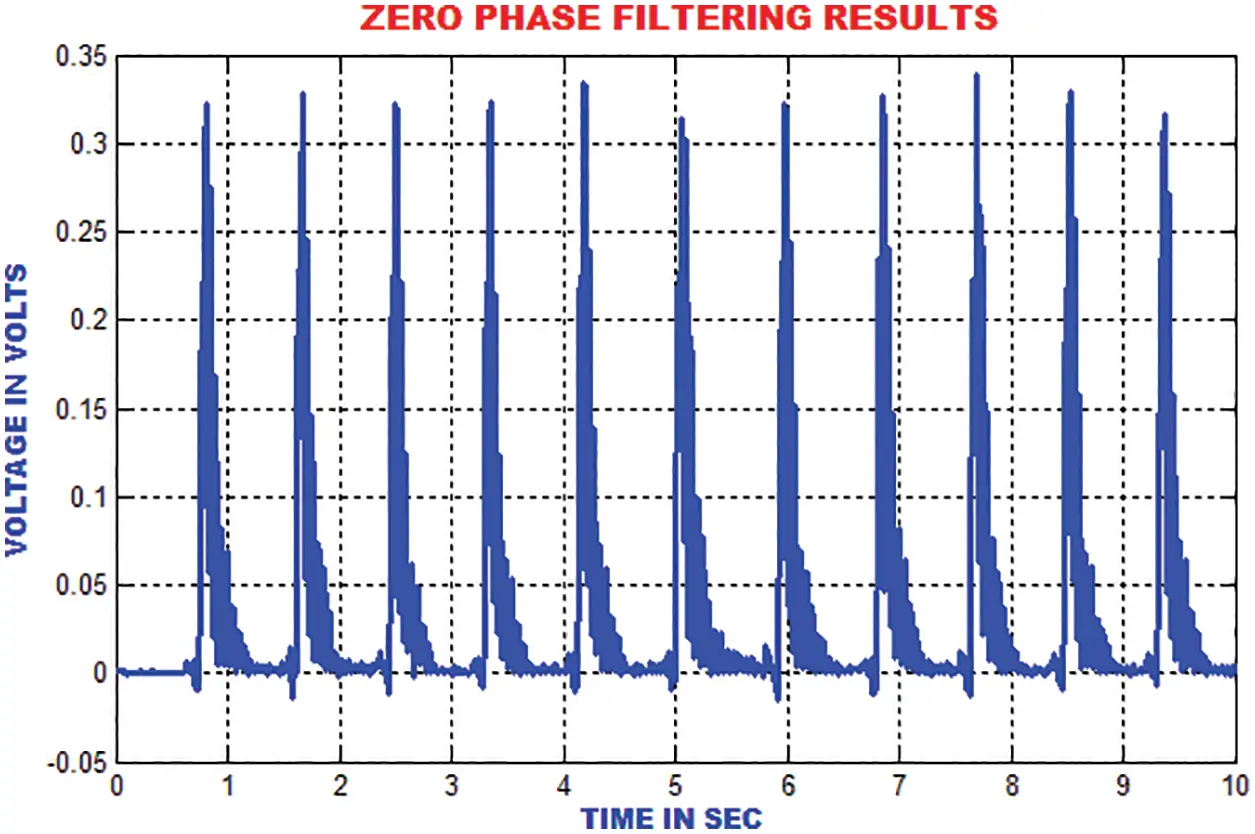A Novel Radial Basis Function Neural Network Approach for ECG Signal ...