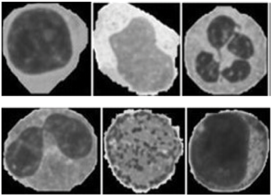 Qualitative Abnormalities of Peripheral Blood Smear Images Using Deep ...