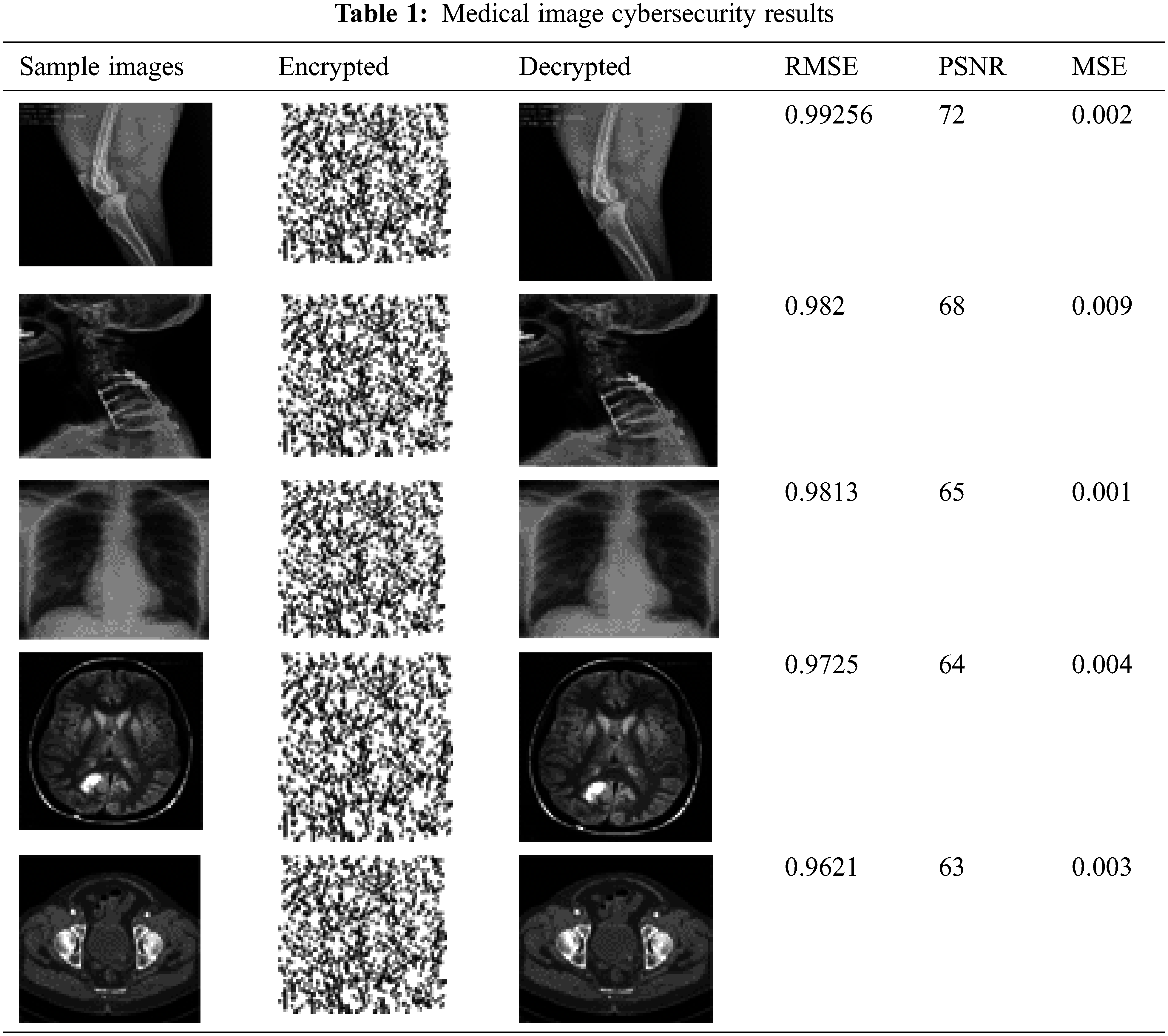 Secured Cyber Security Algorithm for Healthcare System Using Blockchain Technology