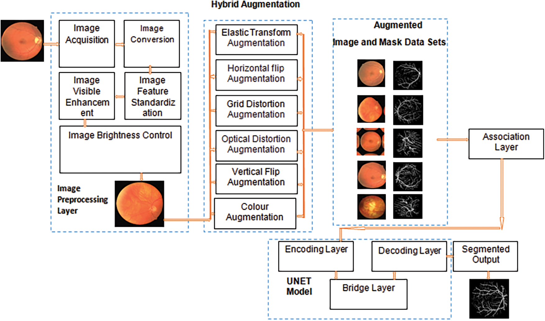 Multilevel Augmentation for Identifying Thin Vessels in Diabetic Retinopathy Using UNET Model