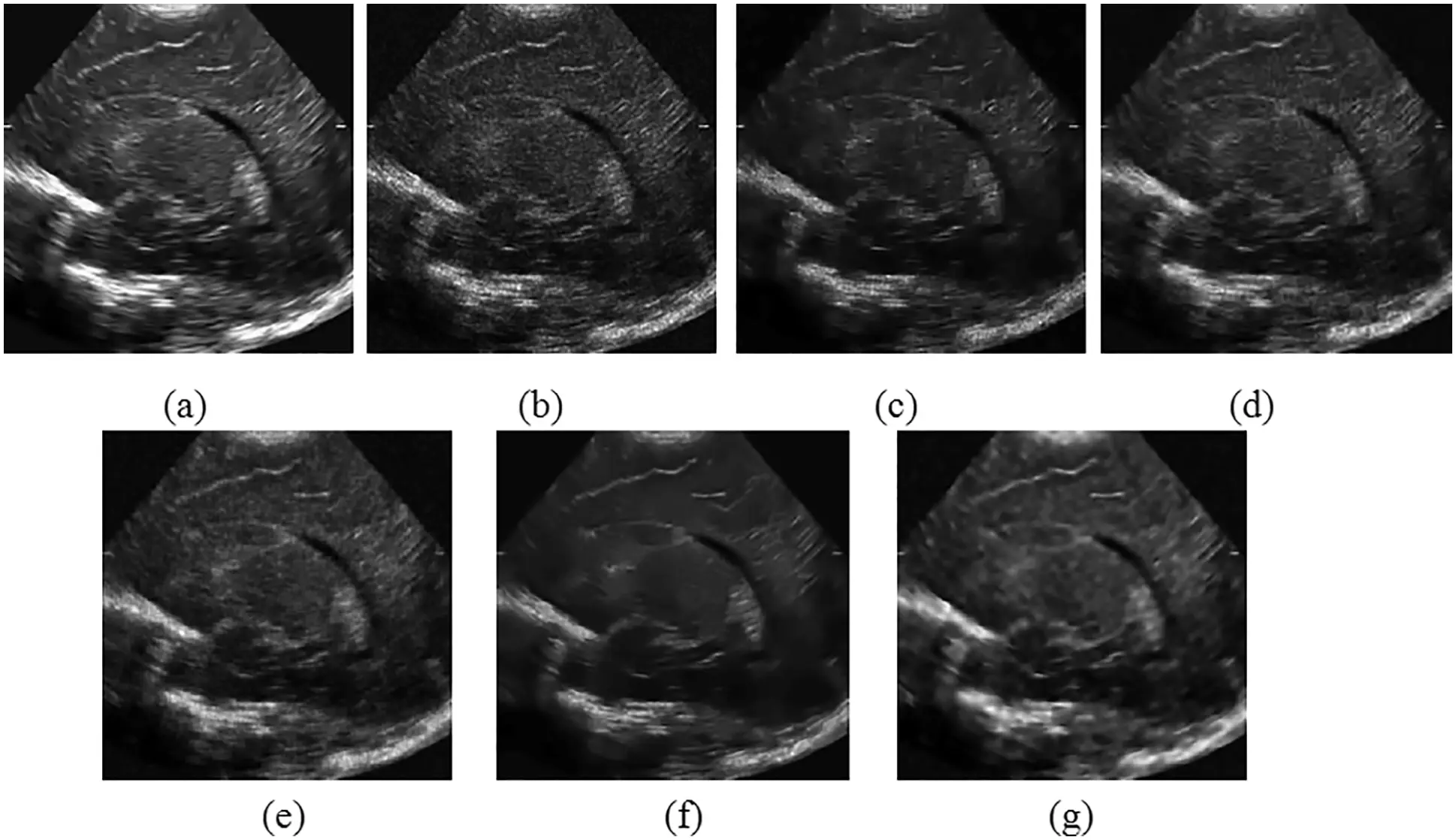 IASC | Free Full-Text | Adaptive Fuzzy Logic Despeckling in Non ...