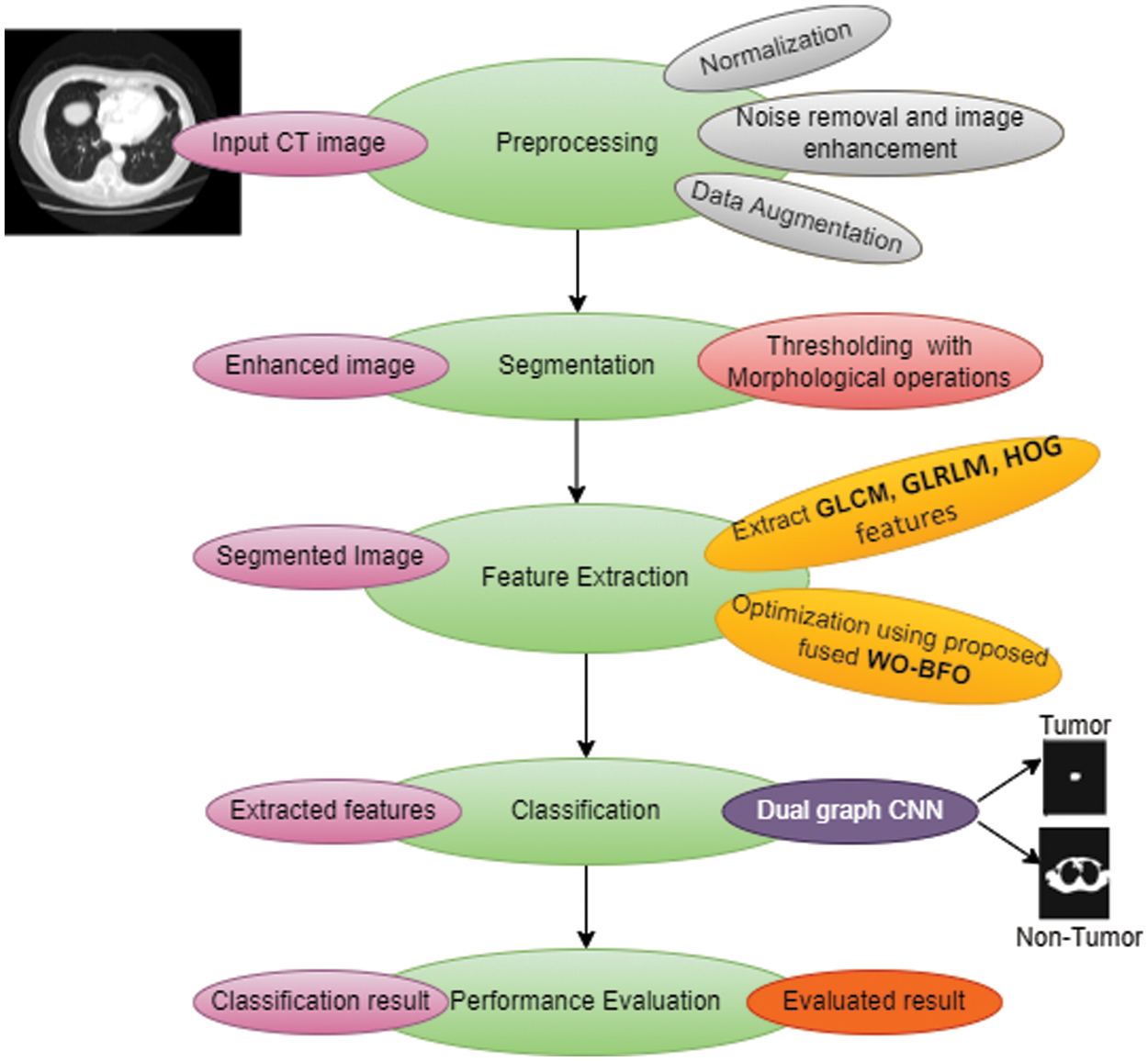 IASC | Free Full-Text | Smart Lung Tumor Prediction Using Dual Graph ...