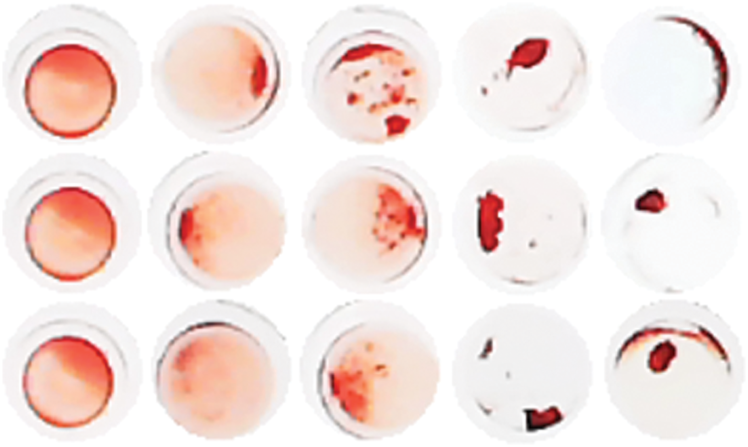 Blood Sample Image Classification Algorithm Based on SVM and HOG