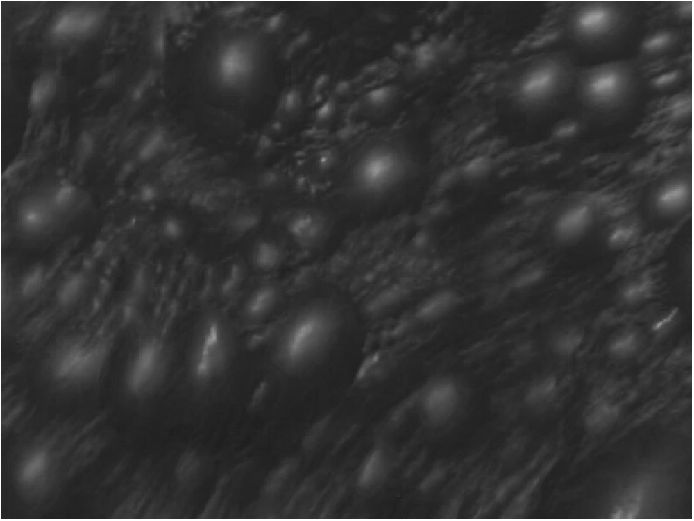 Research on Image Quality Enhancement Algorithm Using Hessian Matrix