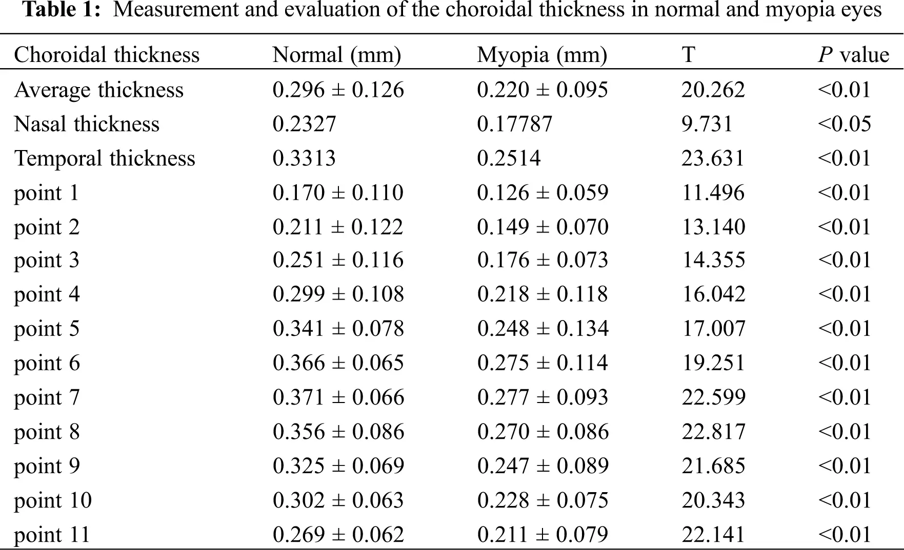 Measurement of Myopia and Normal Human Choroidal Thickness Using ...