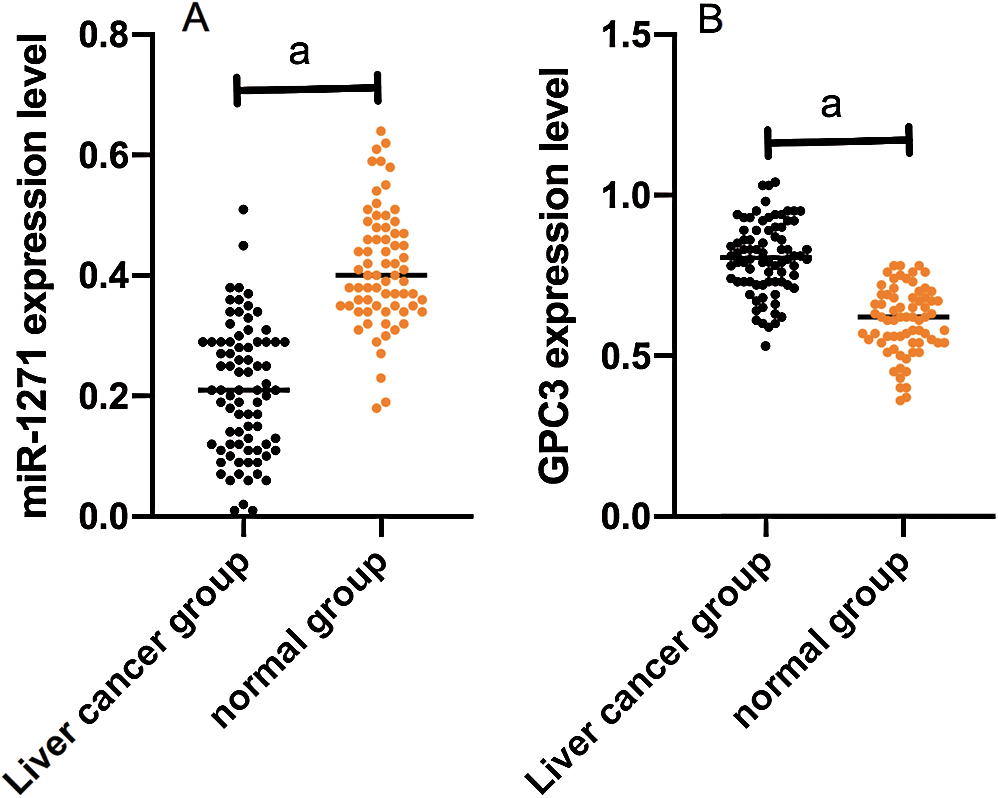 Value of Mir-1271 and GPC3 in Prognosis Evaluation of Liver Cancer Patients after Liver ...