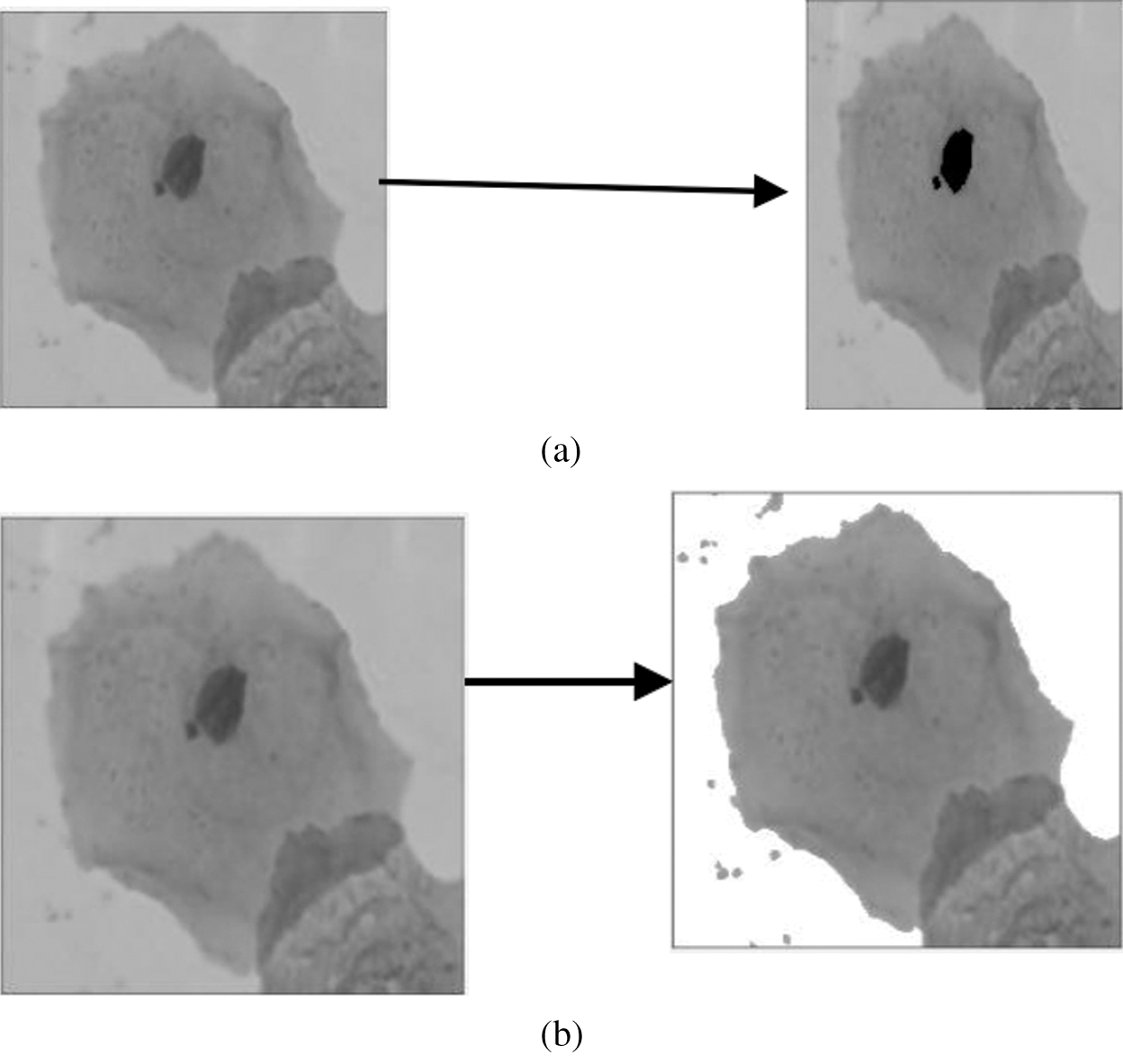 Nucleus Detection on Pap Smear Images for Cervical Cancer Diagnosis: A Review Analysis
