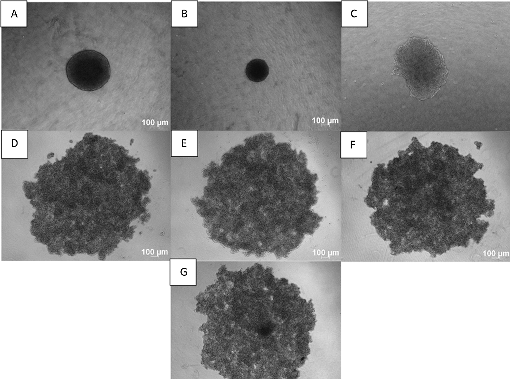 Growth and Invasion of 3D Spheroid Tumor of HeLa and CasKi Cervical ...