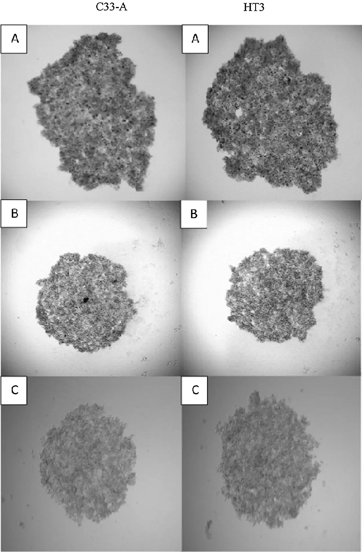 Growth and Invasion of 3D Spheroid Tumor of HeLa and CasKi Cervical ...