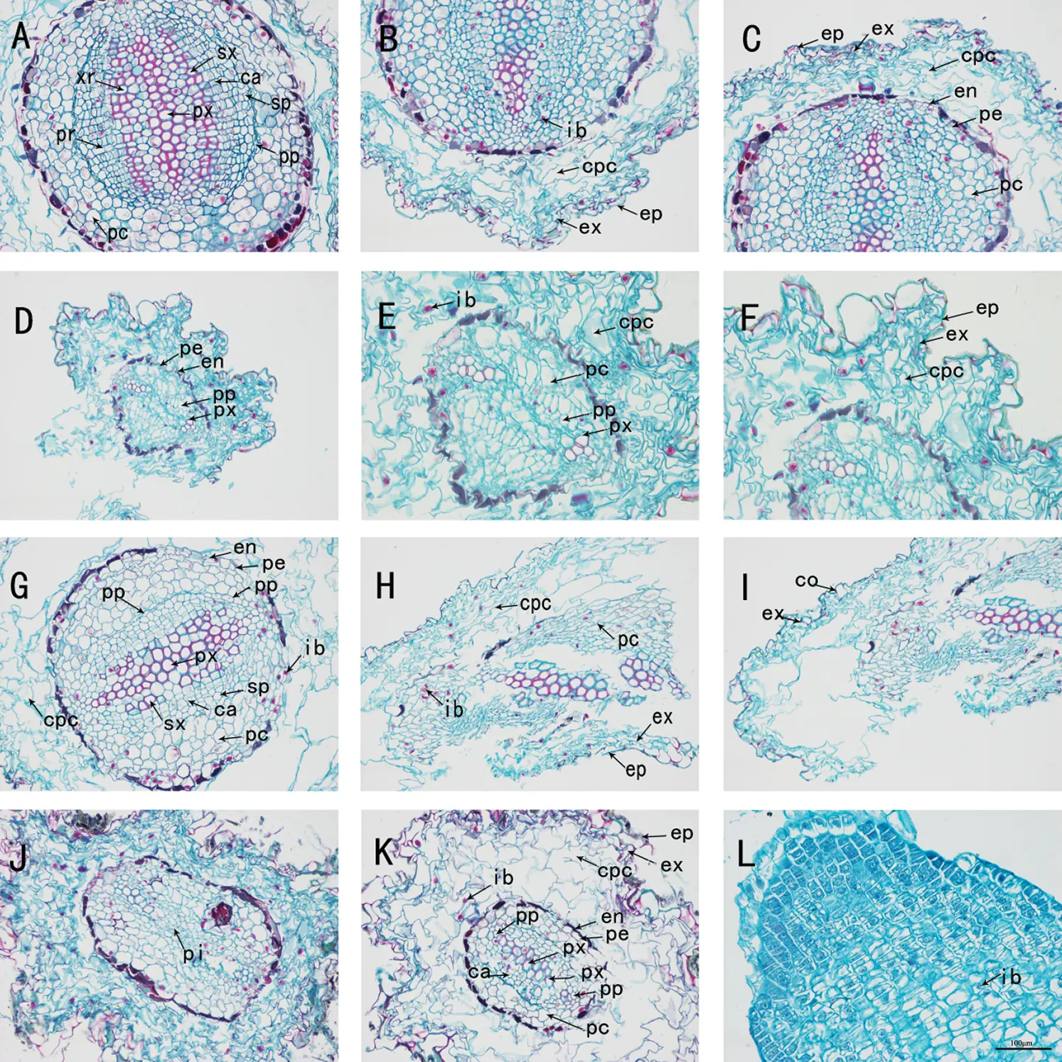 Comparison of Morphological and Anatomical Characteristics of Taxus ...