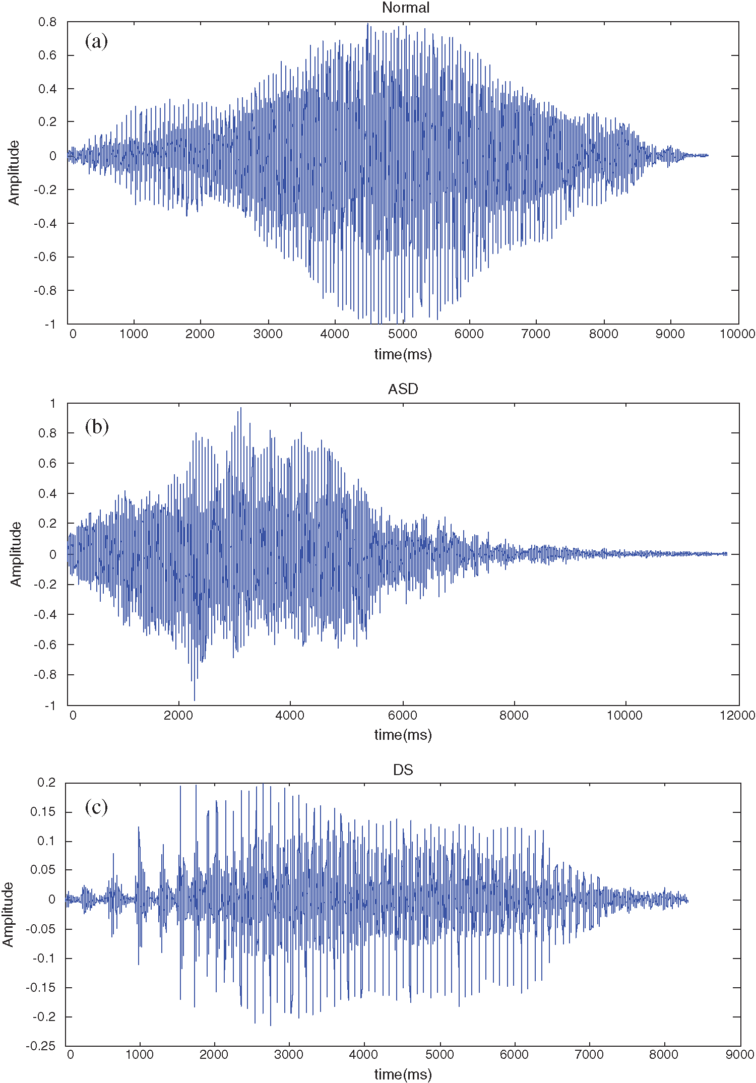 Combined Signal Processing Based Techniques and Feed Forward Neural ...